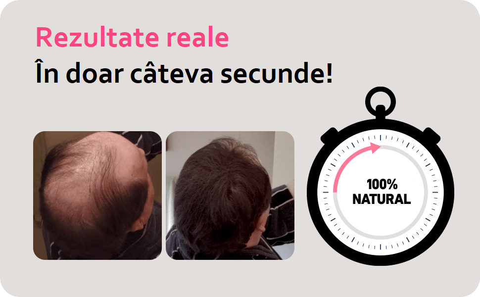 Pachet x 2 Fibre pentru par rar Sevich alb 25 g la CEL.ro