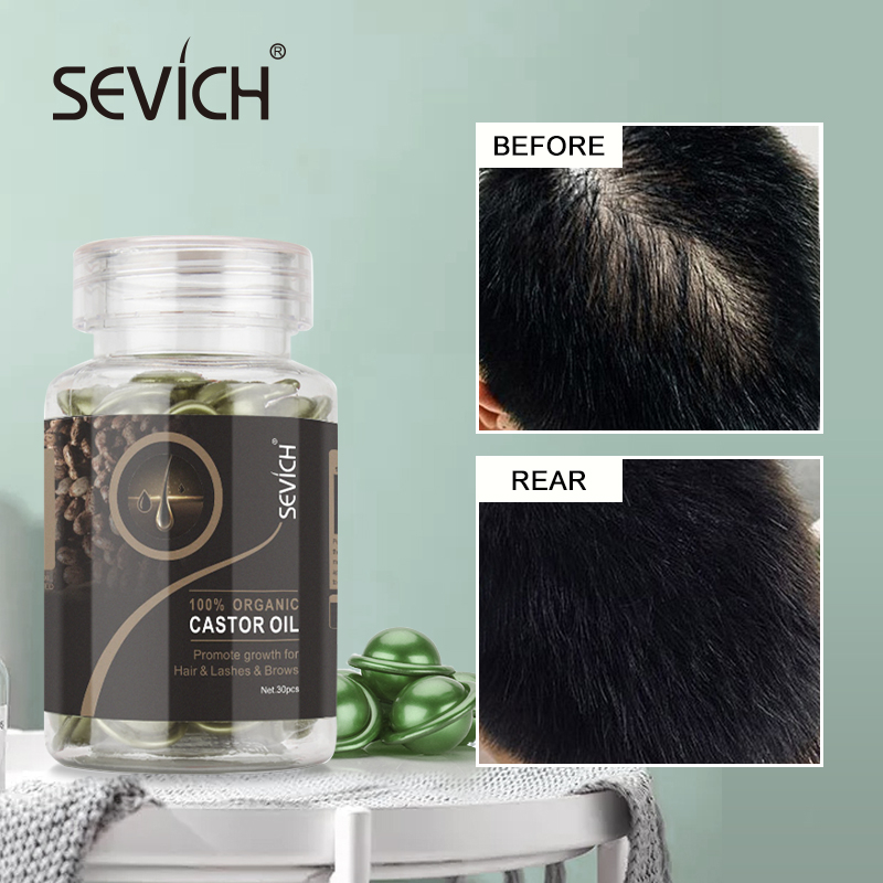 Capsule pentru crestere par gene si sprancene 100 Organic Ulei de ricin ...