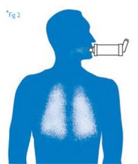 Philips Respironics Optichamber Diamond cu masca 5 ani - adulti la CEL.ro