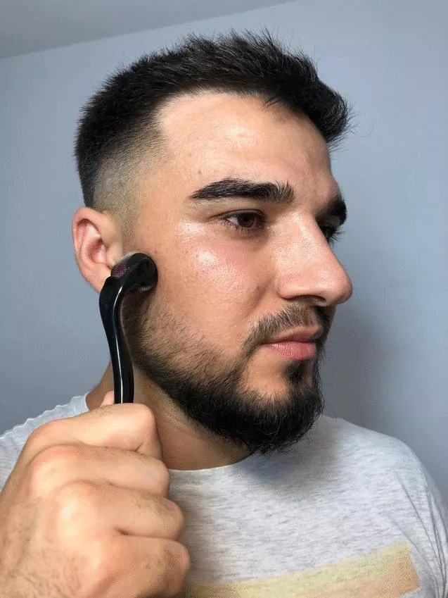 Spuma Minoxidil Kirkland 5 + Dermaroller 540 ace din titan Tratament ...