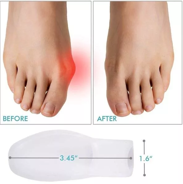 Set 2 buc protectii pentru monturi separator degete corector pozitie ...